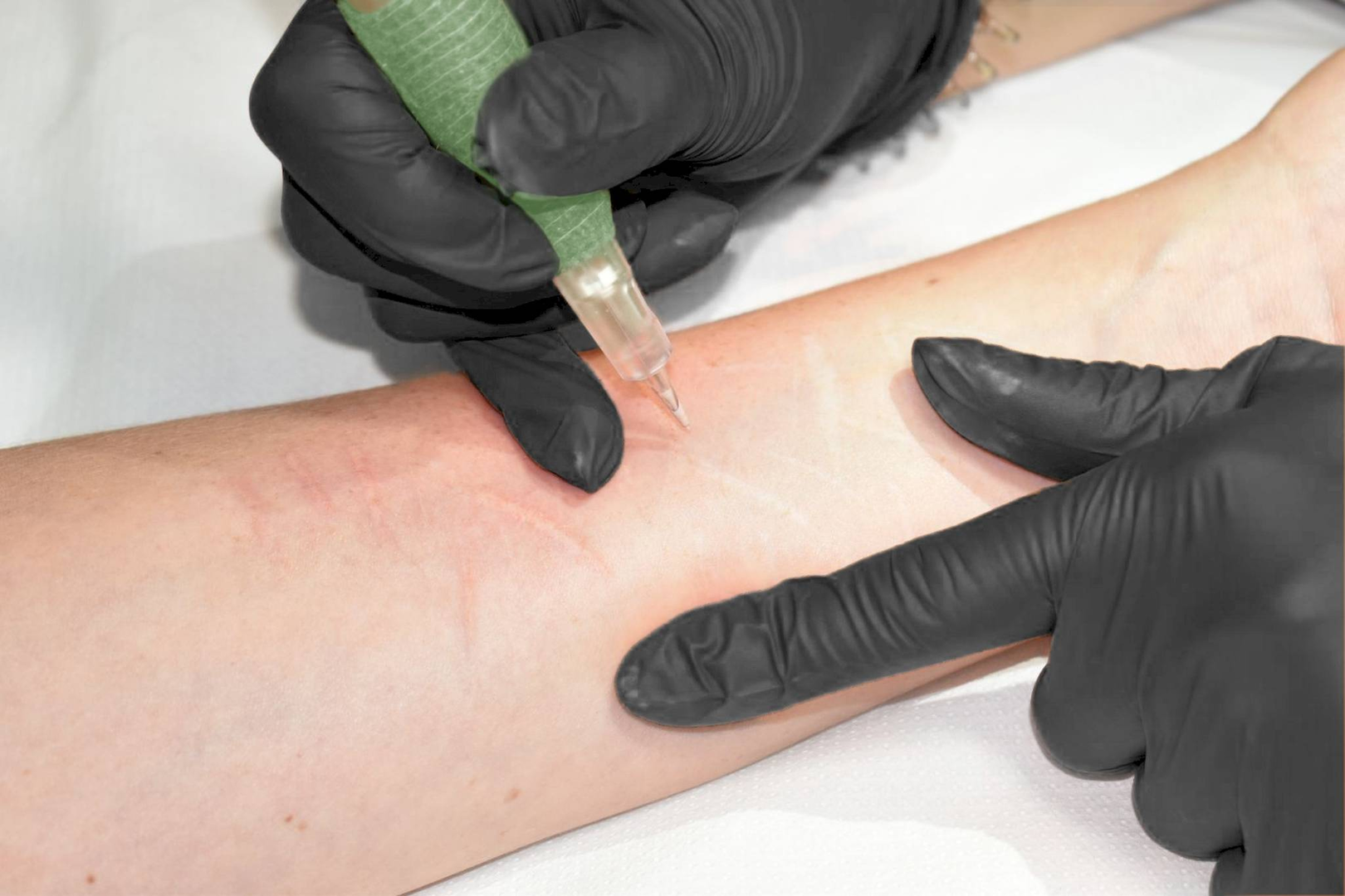 Skin Camouflage - Marcella's Beauty Studio - Ipswich, Suffolk, UK